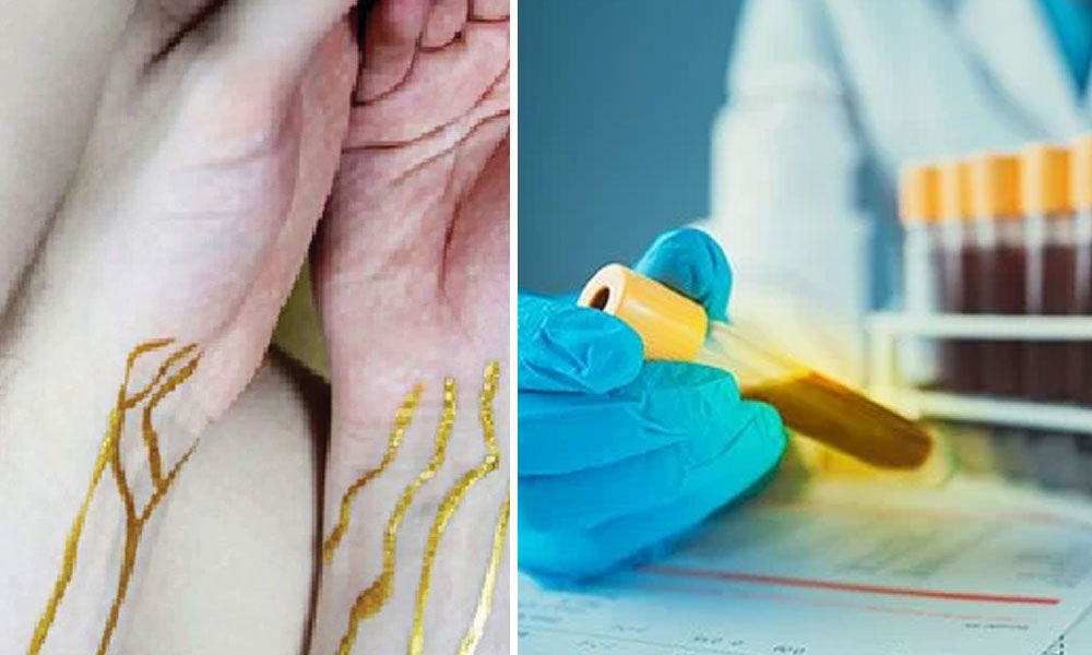 ଦୁନିଆର ୪୫ ଜଣଙ୍କ ପାଖରେ ଅଛି Golden Blood Group; ଗୋଟିଏ ବୁନ୍ଦା ସୁନାଠୁ ବି ...